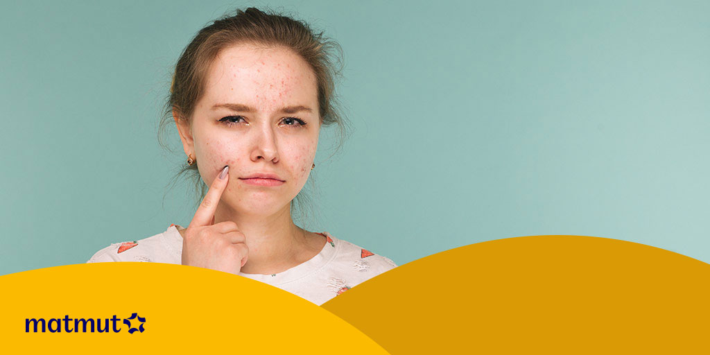 Les différents types d’acné: leurs symptômes, leurs causes, leur ...