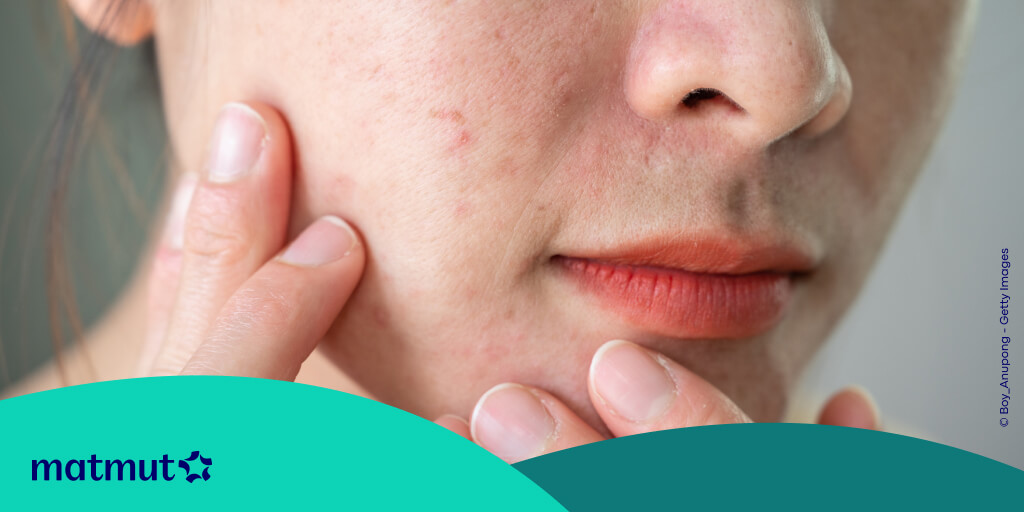 Nos conseils pour prendre soin de votre peau | Matmut