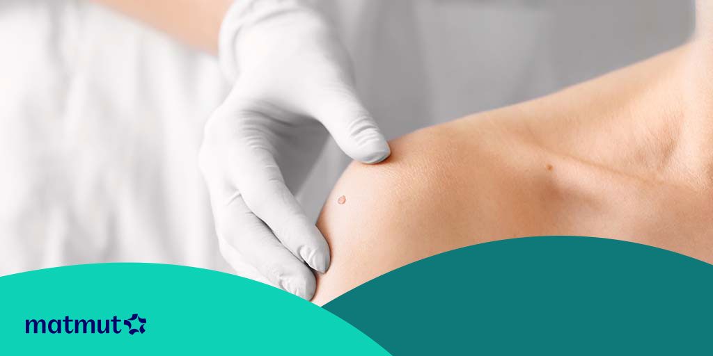 Consulter un dermatologue : tout savoir | Matmut
